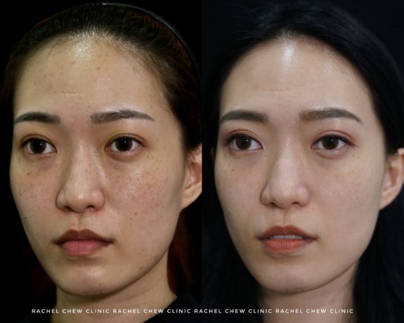 10 Certified Aesthetic Clinics In Klang Valley With Before & After Photos